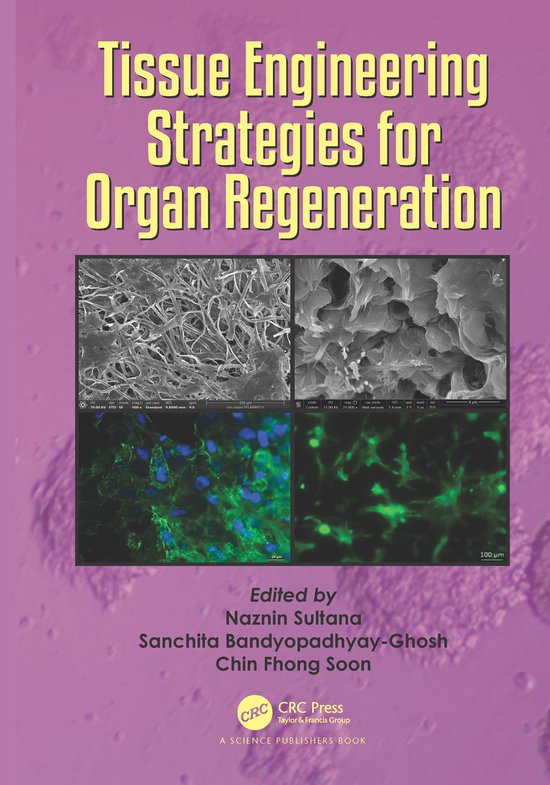 Tissue Engineering Strategies for Organ Regeneration, Naznin Sultana ...