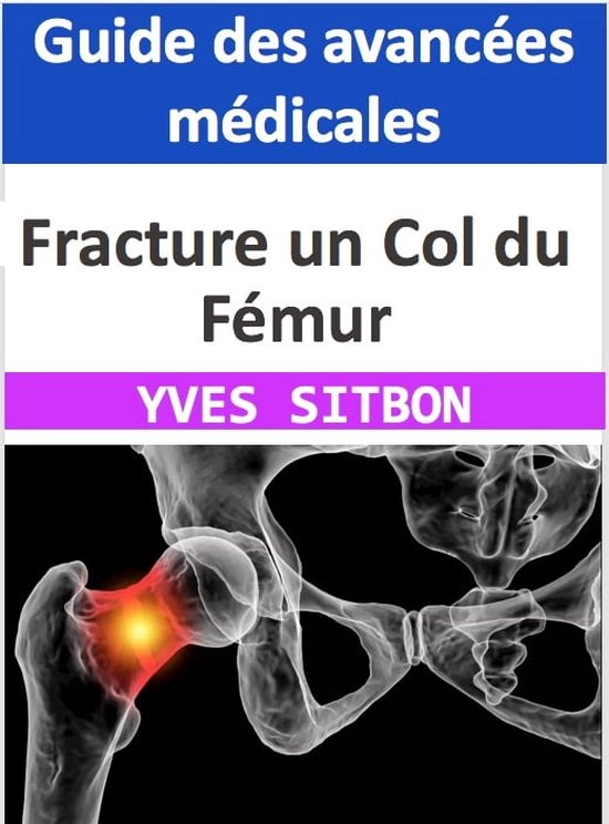 Fracture un Col du Fémur : Guide des avancées médicales (ebook), YVES ...