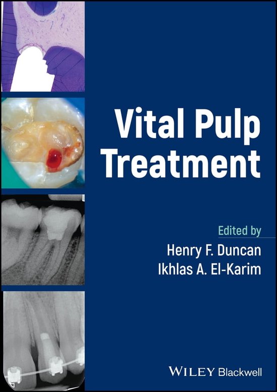 Vital Pulp Treatment (ebook) | 9781119930402 | Boeken | bol