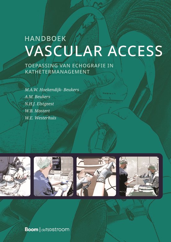 Handboek vascular access | 9789024465132 | M.A.W. Hoekendijk- Beukers | Boeken | bol