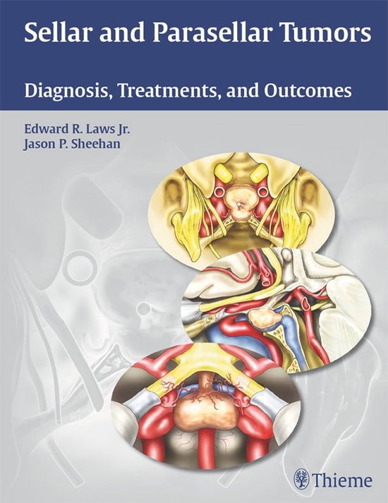 Sellar and Parasellar Tumors (ebook) | 9781638530404 | Boeken | bol