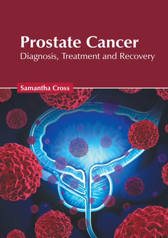 Prostate Cancer: Diagnosis, Treatment and Recovery | 9781632429209 ...