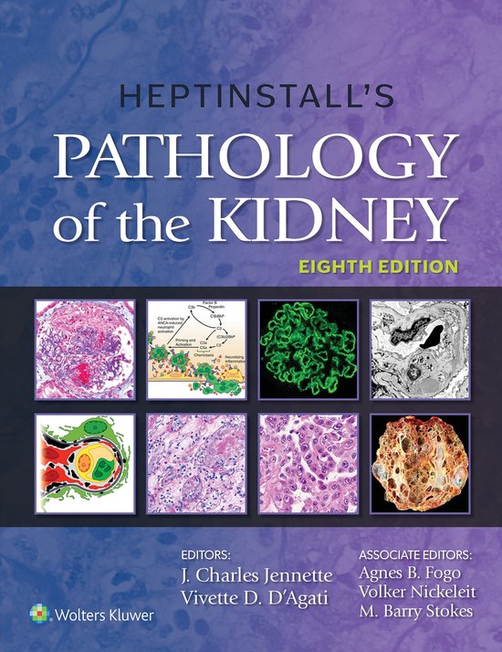 Heptinstall's Pathology of the Kidney (ebook), J. Charles Jennette | 9781975161552 |... | bol.com