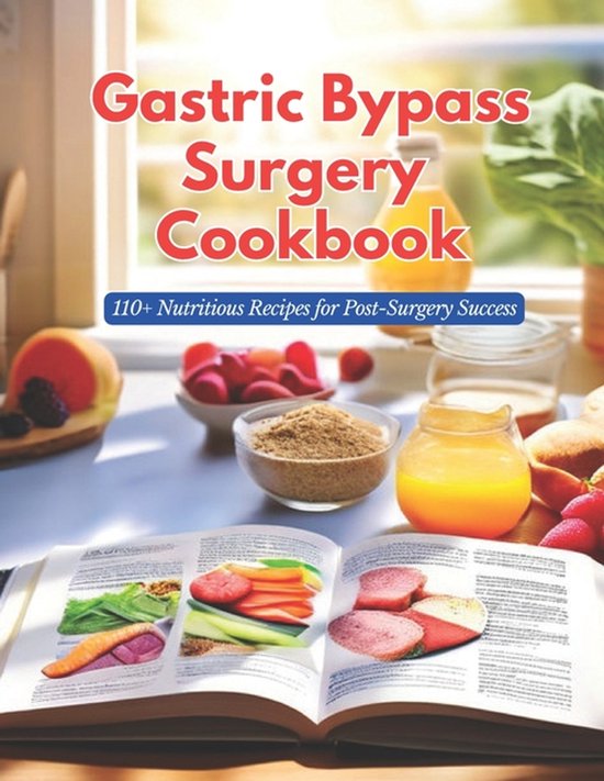 Gastric Bypass Surgery Cookbook, Daisy Robinson | 9798328572453 ...