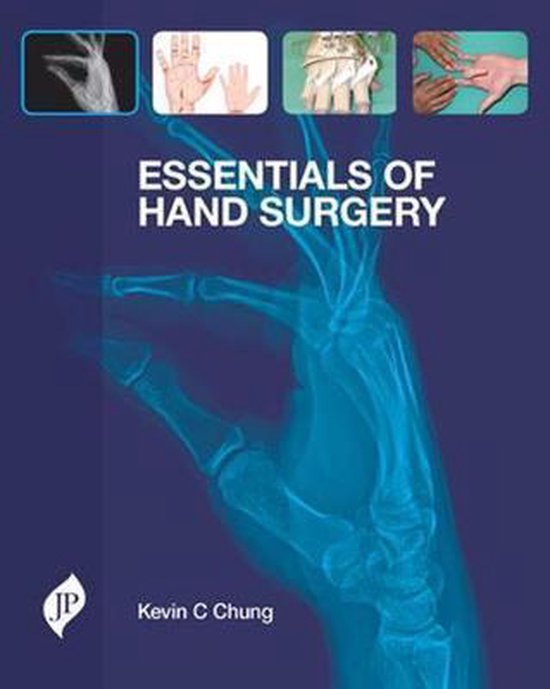 Essentials Of Hand Surgery | 9781907816321 | Kevin C. Chung | Boeken | bol