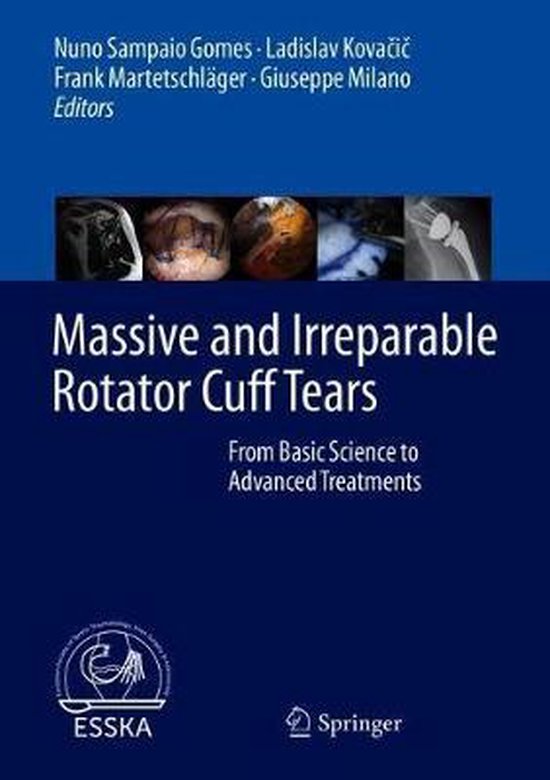 Massive and Irreparable Rotator Cuff Tears | 9783662611616 | Boeken ...