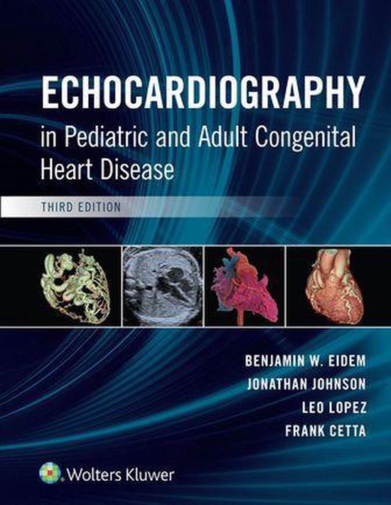 Echocardiography in Pediatric and Adult Congenital Heart Disease (ebook), Benjamin W.... | bol.com