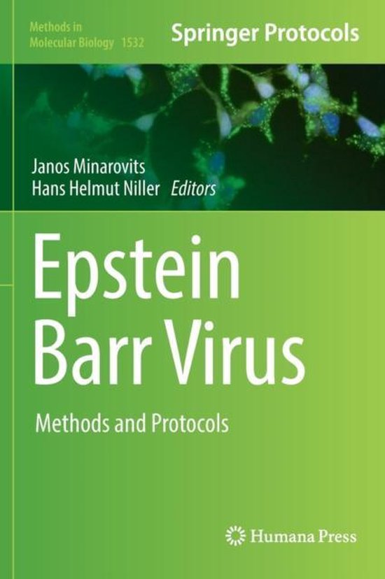 Epstein Barr Virus | 9781493966530 | Boeken | bol.com