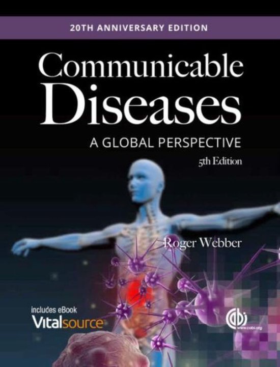 Communicable Diseases 5e | 9781780647425 | Roger Webber | Boeken | bol