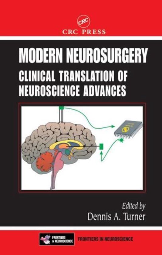 Modern Neurosurgery | 9780849314827 | Dennis A. Turner | Boeken | bol.com