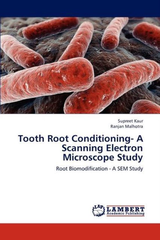Tooth Root Conditioning- A Scanning Electron Microscope Study ...