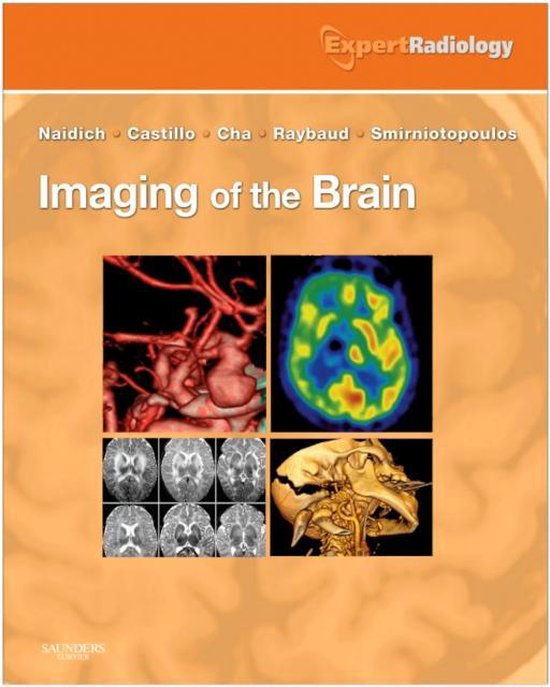 Imaging of the Brain | 9781416050094 | Thomas P. Naidich | Boeken | bol.com