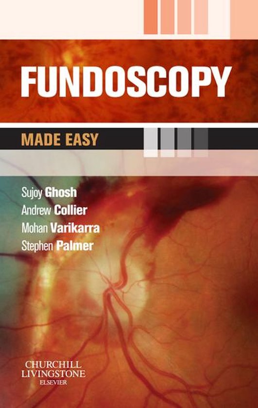 Fundoscopy Made Easy E-Book (ebook), Mohan Varikkara, Ms, Frcs (Edin ...