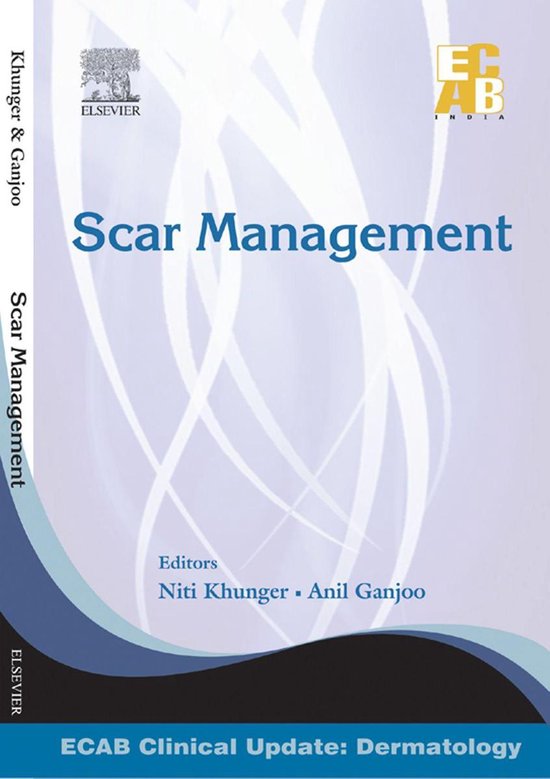 Scar Management - ECAB (ebook) | 9788131231715 | Boeken | bol.com