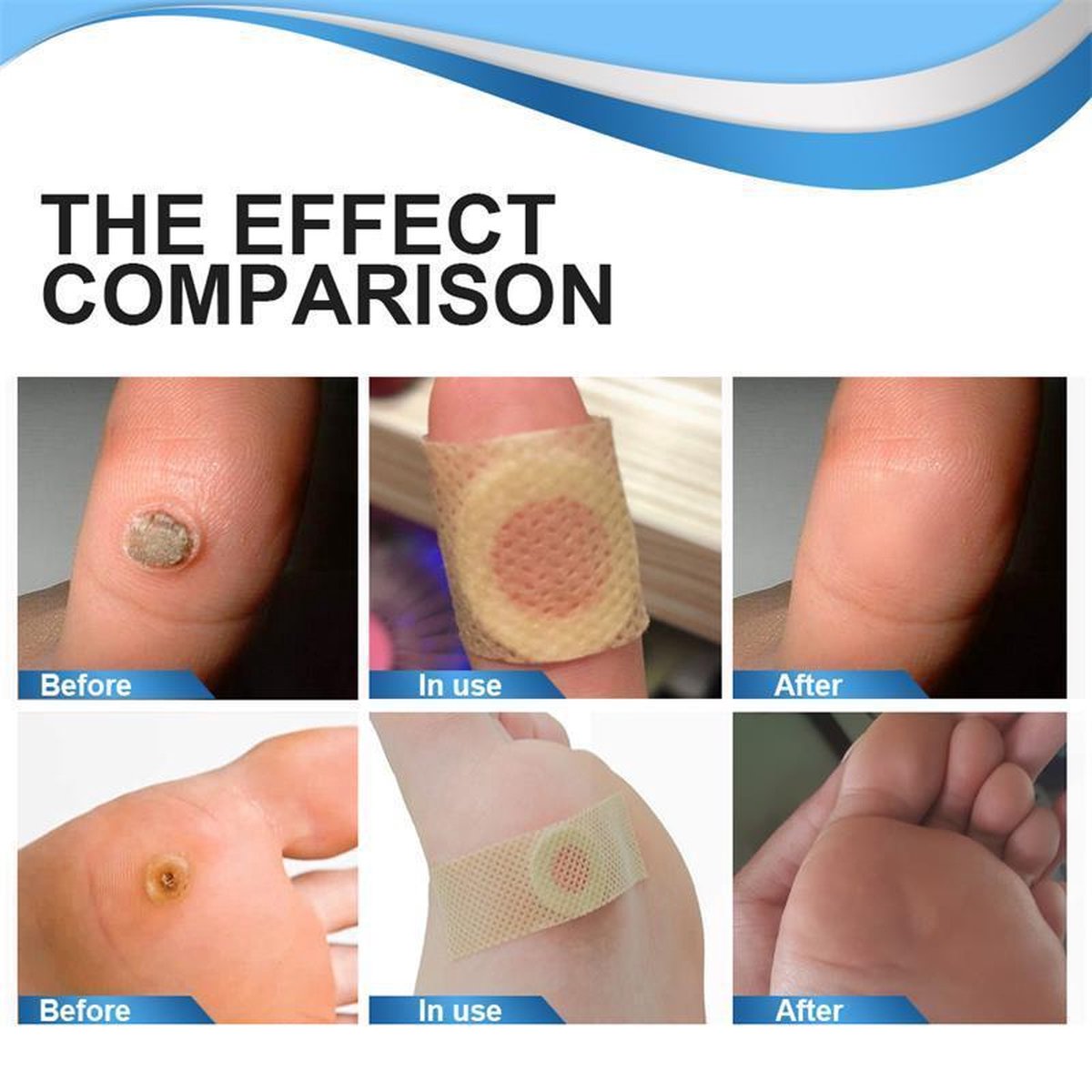 bol.com | Wratten Pleisters