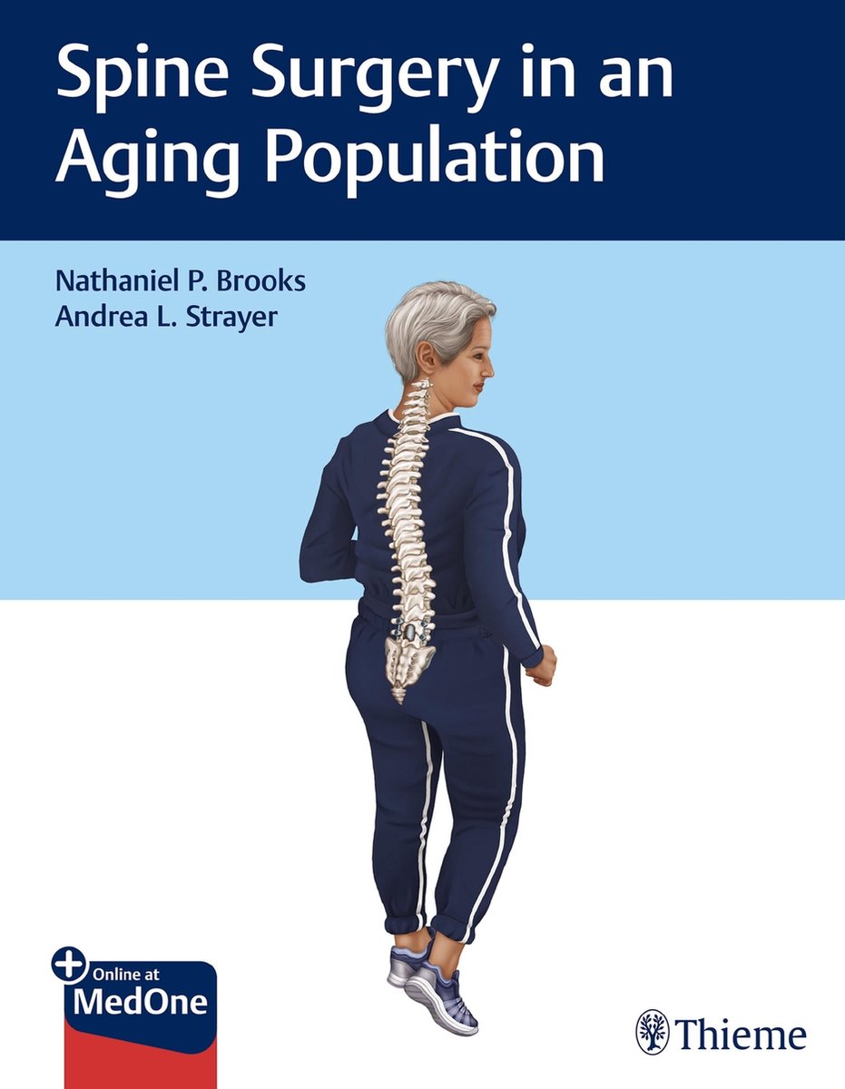 Spine Surgery in an Aging Population (ebook), Andrea L. Strayer ...