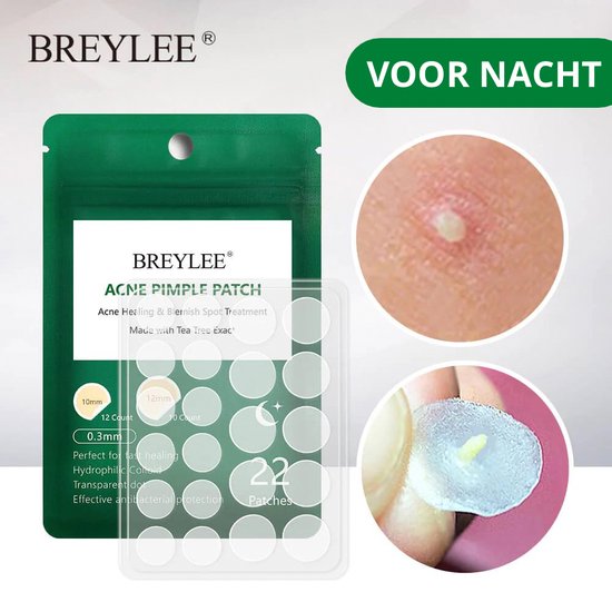 ACNE PIMPLE PATCH | TEA TREE | NACHT BEHANDELING | PUIST | PLEISTER ...