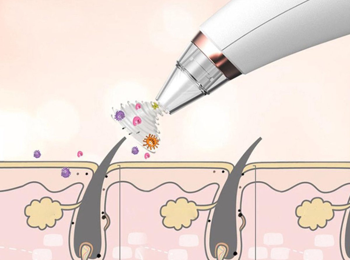 puisten verwijderaar-mee eter-apparaat-opzet stukken-compact-draagbaar ...