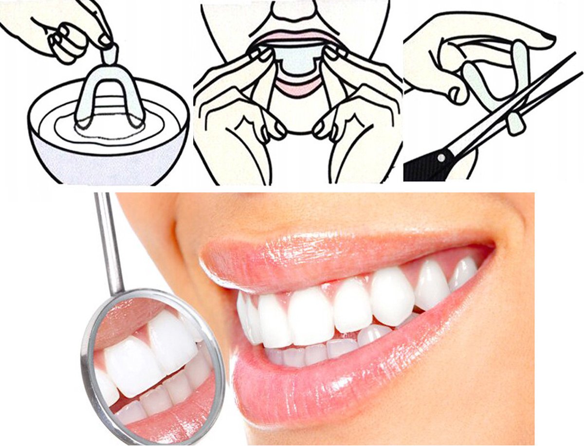 Borvat® | Tanden bitjes voor tanden bleken | vechtsporten | tanden ...