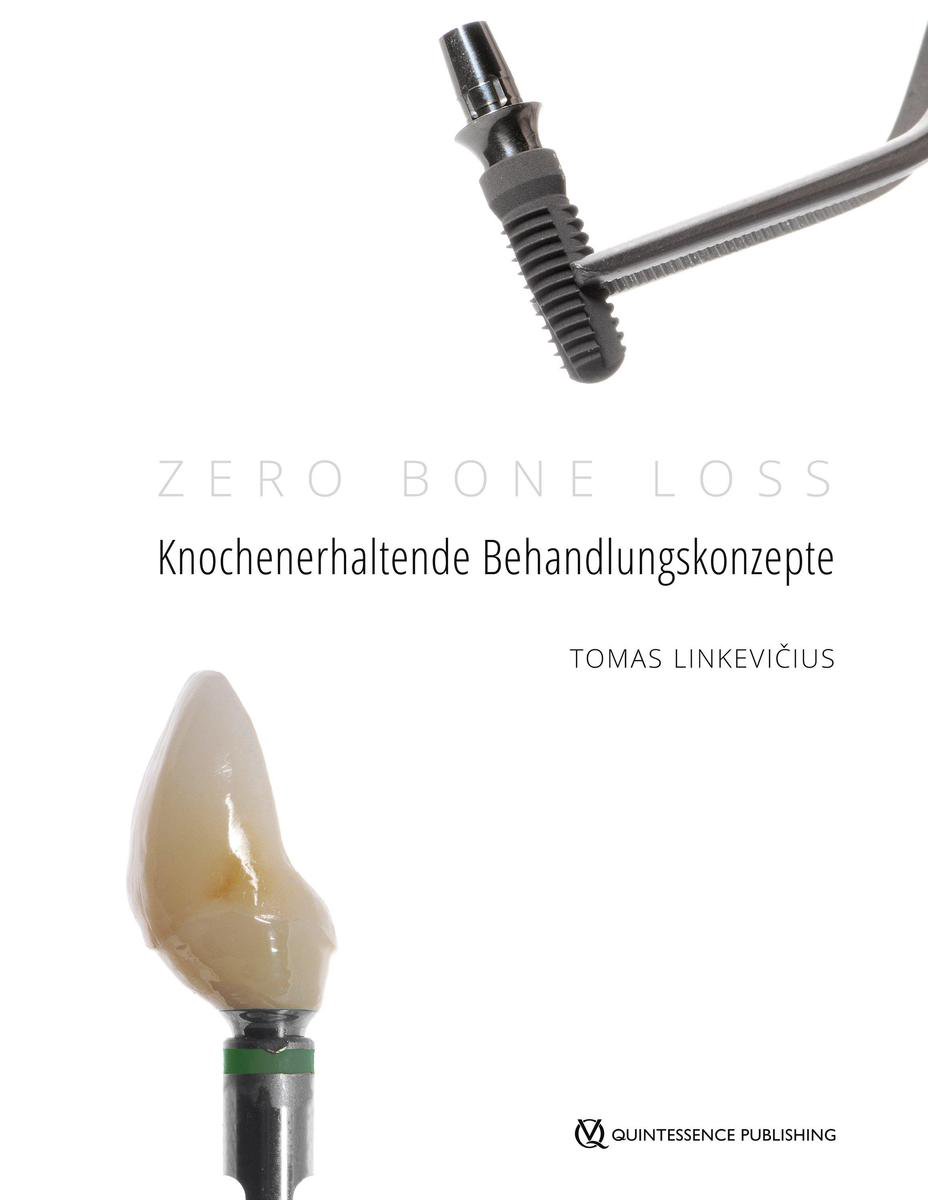 Zero Bone Loss: Knochenerhaltende Behandlungskonzepte (ebook), Tomas ...