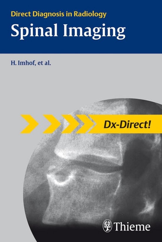 Spinal Imaging (ebook) | 9783132579767 | Boeken | bol