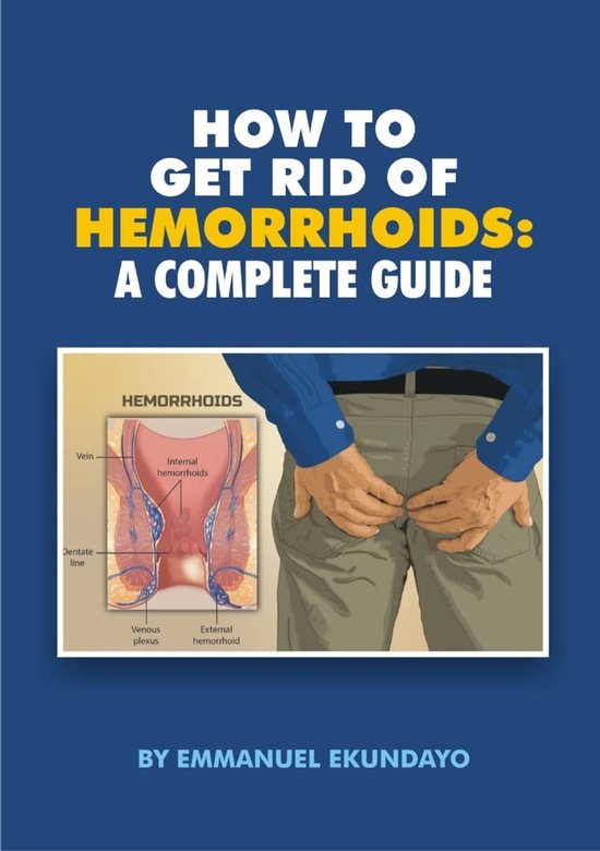 How to Get Rid of Hemorrhoids: A Complete Guide (ebook), Emmanuel ...