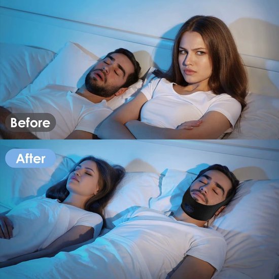 Kinband voor Slapen – Anti-Snurk Riem voor CPAP Gebruikers ...