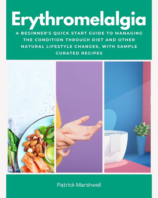Erythromelalgia Ebook Patrick Marshwell 6610000399949 Boeken