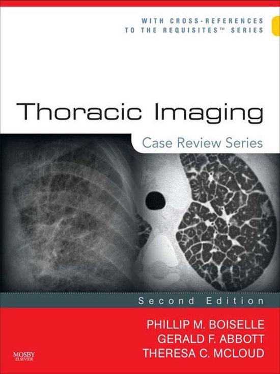 Thoracic Imaging E-Book (ebook), Theresa McLoud | 9780323086332 ...