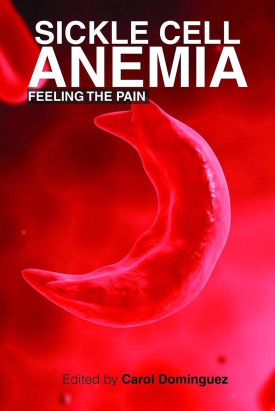 Sickle Cell Anemia (ebook), Carol Dominguez | 9781636260471 | Boeken ...