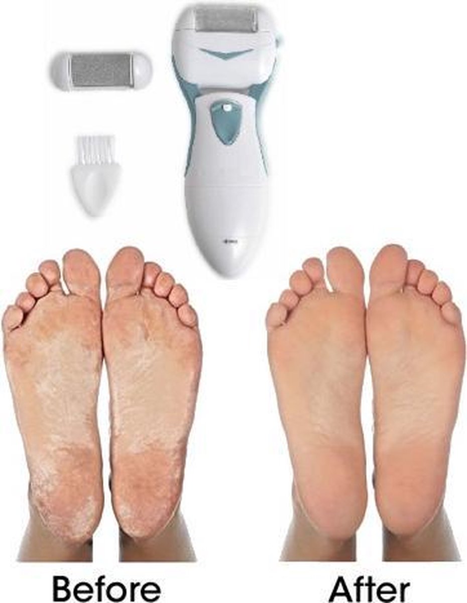 FOOTSTEPS Elektrische voetenvijl | bol.com