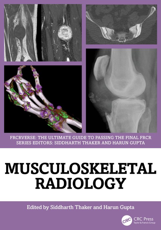 FRCRverse- Musculoskeletal Radiology | 9781032815152 | Boeken | bol