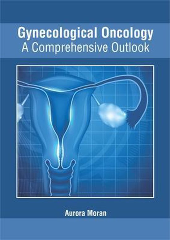 Gynecological Oncology | 9781632427465 | Boeken | bol.com