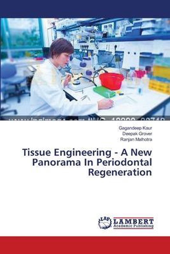 Tissue Engineering - A New Panorama In Periodontal Regeneration ...
