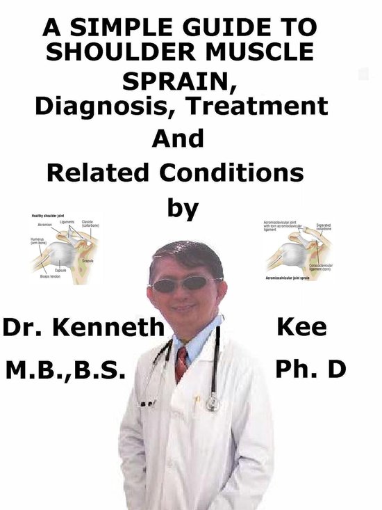 A Simple Guide to Shoulder Muscle Sprain, Diagnosis, Treatment and ...