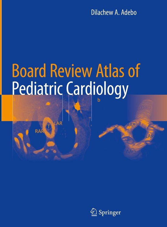 Board Review Atlas of Pediatric Cardiology (ebook) | 9783031594939 | Boeken | bol