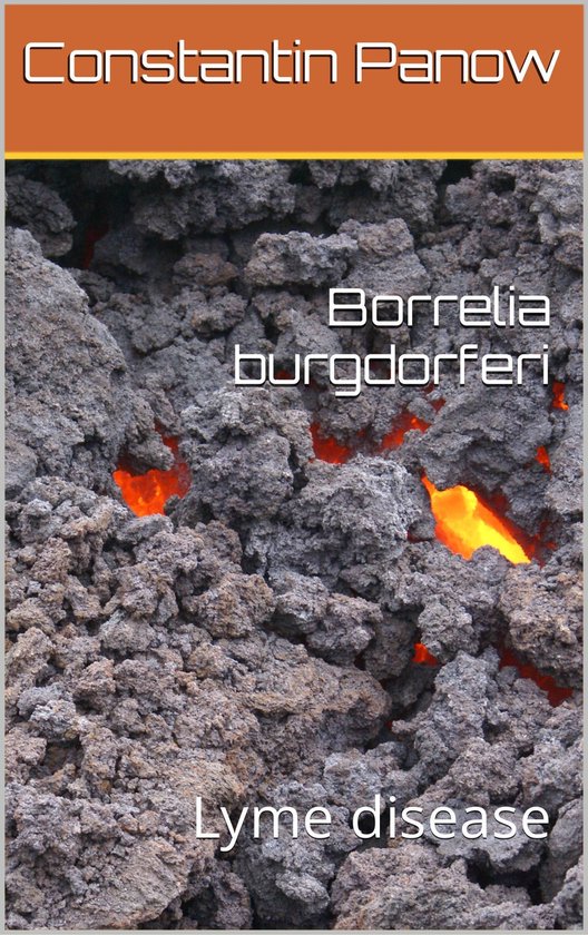 Borrelia Burgdorferi-Lyme Disease (ebook), Constantin Panow ...