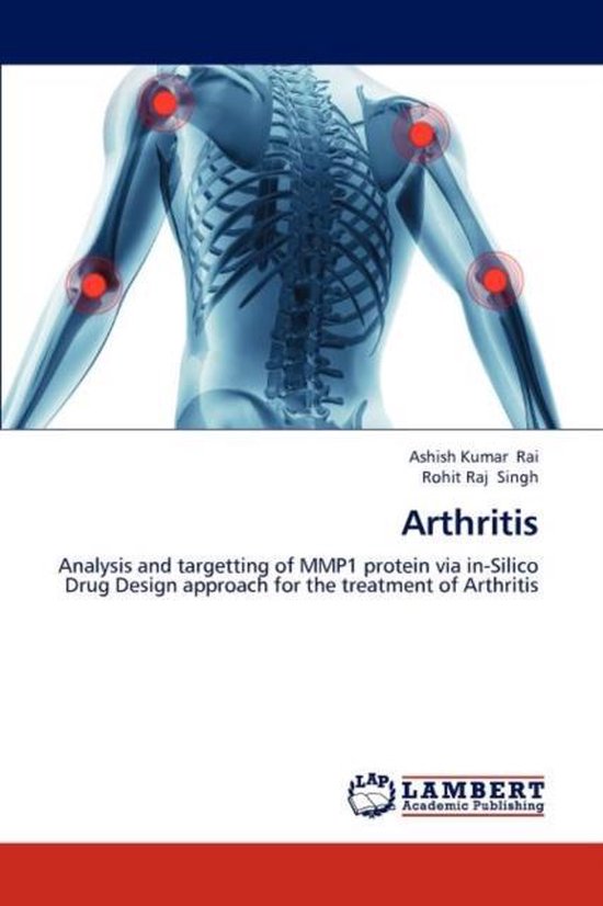 Arthritis | 9783659107962 | Ashish Kumar Rai | Boeken | bol