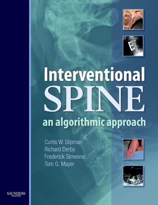 Interventional Spine | 9780721628721 | Curtis W. Slipman, Md | Boeken ...