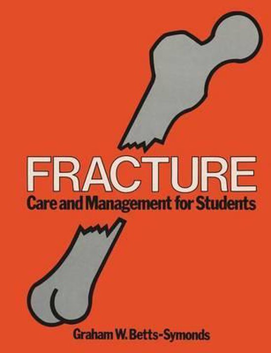 Fracture | 9780333344026 | Graham W.Betts- Symonds | Boeken | bol.com