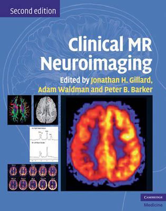 Clinical MR Neuroimaging | bol.com