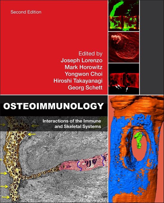 Osteoimmunology | 9780128005712 | Joseph Lorenzo | Boeken | bol