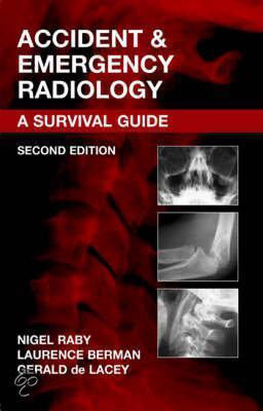 Accident and Emergency Radiology, | 9780702026676 | Nigel Raby | Boeken ...
