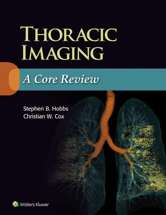 Thoracic Imaging: A Core Review (ebook), Stephen Hobbs | 9781469898858 ...