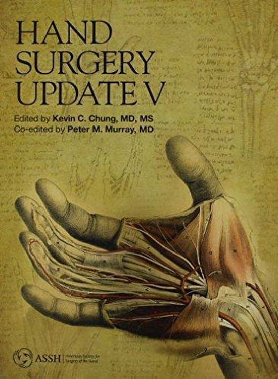 Hand Surgery Update V, Kevin C Chung, Ed. | 9781935121114 | Boeken ...
