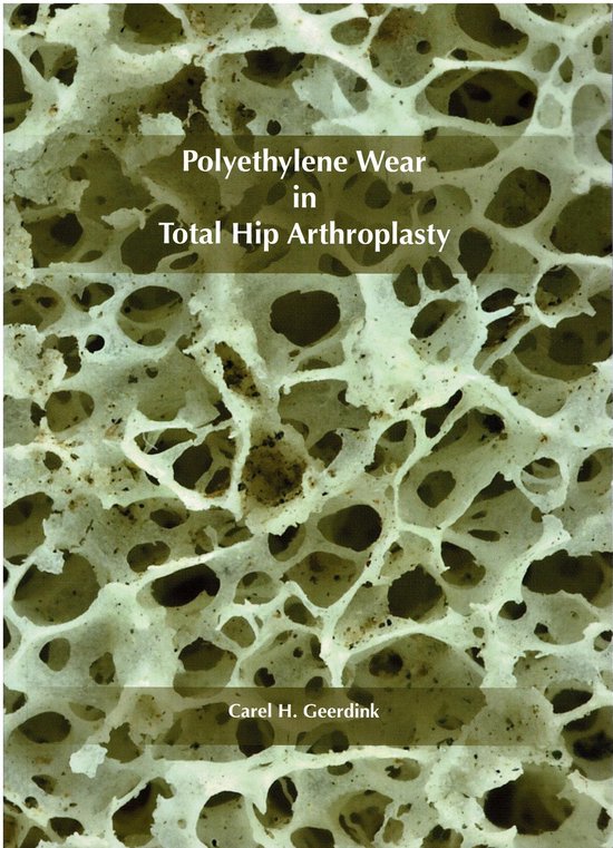 Polyethylene Wear in Total Hip Arthroplasty, C. Geerdink ...