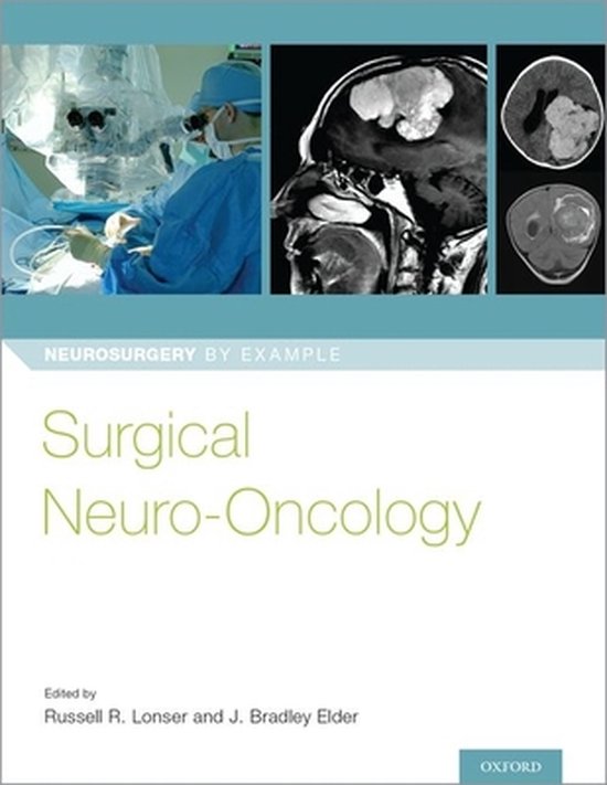 Surgical Neuro-Oncology | 9780190696696 | Lonser, Russell R. | Boeken | bol.com