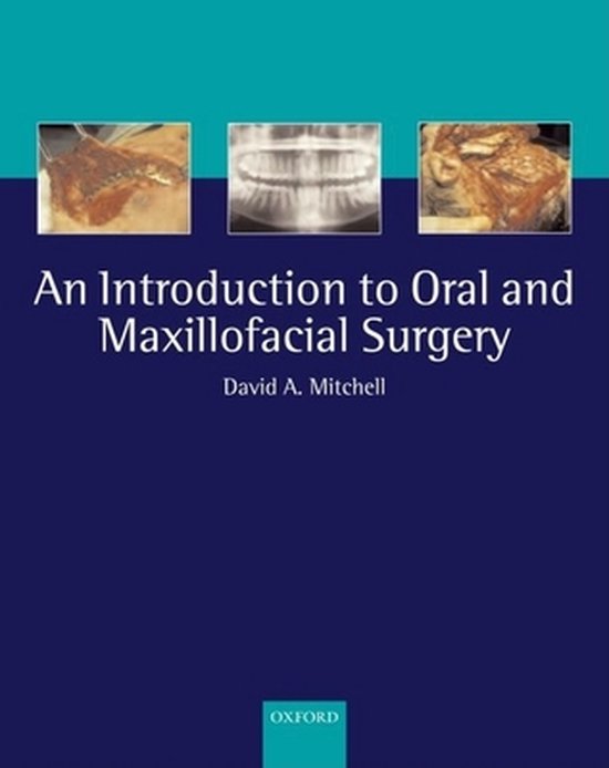 An Introduction to Oral and Maxillofacial Surgery, David Andrew ...