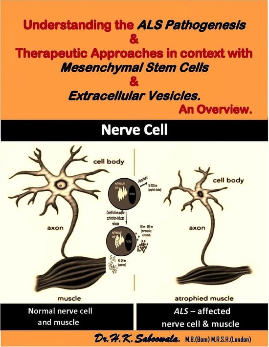 Understanding the ALS Pathogenesis & Therapeutic Approaches in context ...