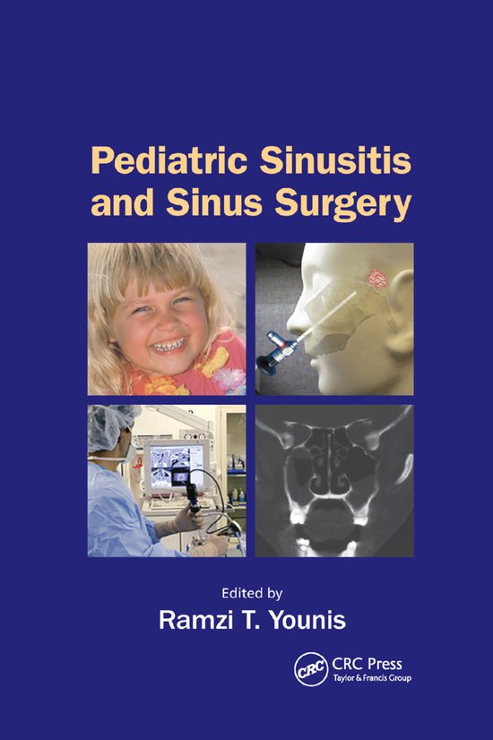 Pediatric Sinusitis and Sinus Surgery | 9780367392055 | Livres | bol